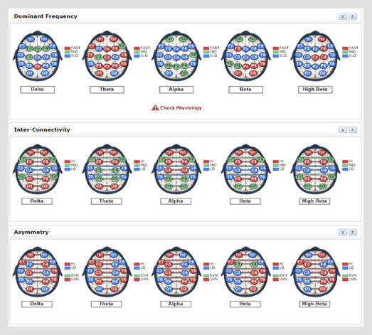What to Expect with Neurofeedback Training? | Capital District ...